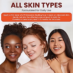 e70 Intensive Healing Scar Cream - Fast Repair Surgical Scars, C-Section, Stretch Marks, Keloids, Burns, Old & New Scars. Vitamins Full - All Skin Types - Reduce Acne Spots Appearance - 2.0 Fl Oz