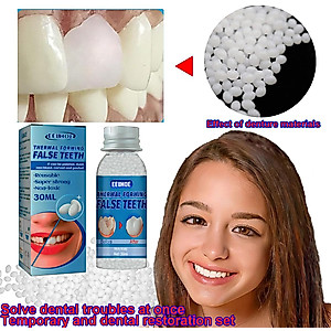 Fake Teeth Repair Kit, Provisional Fake Teeth Replacement Kit for Provisional Restoration 【100% New 30Ml -1 Bottle】