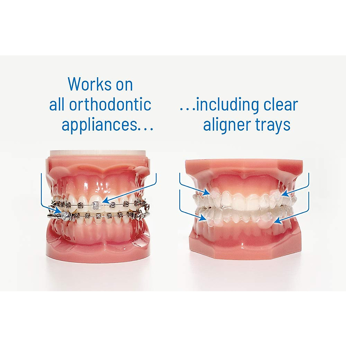OrthoDots CLEAR – Moisture Activated Braces Wax Alternative for Pain Caused by Braces, Clear Aligner Trays, and Other Orthodontic Appliances. OrthoDots Stick Better and Stay on Longer than Dental Wax.