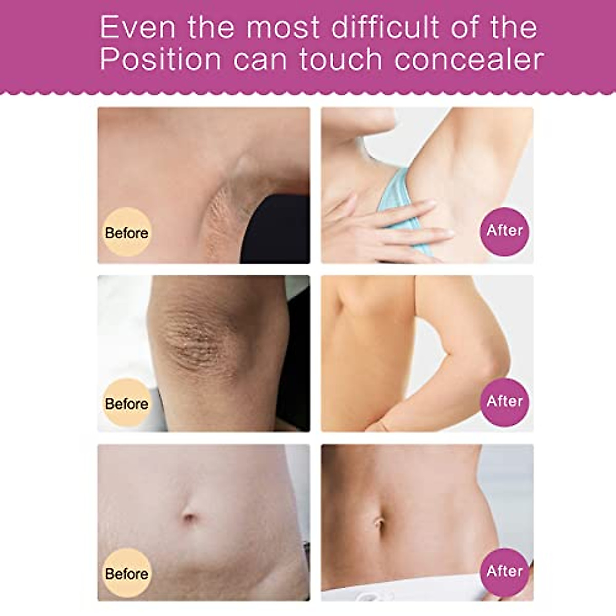 Dark Spot Cream, Natural Underarm Cream, Dark Spot Cream Corrector for Neck and Dark Spots, Sun Spots, Age Spots, Hyperpigmentation, Even Sensitive Skin-Instant Result