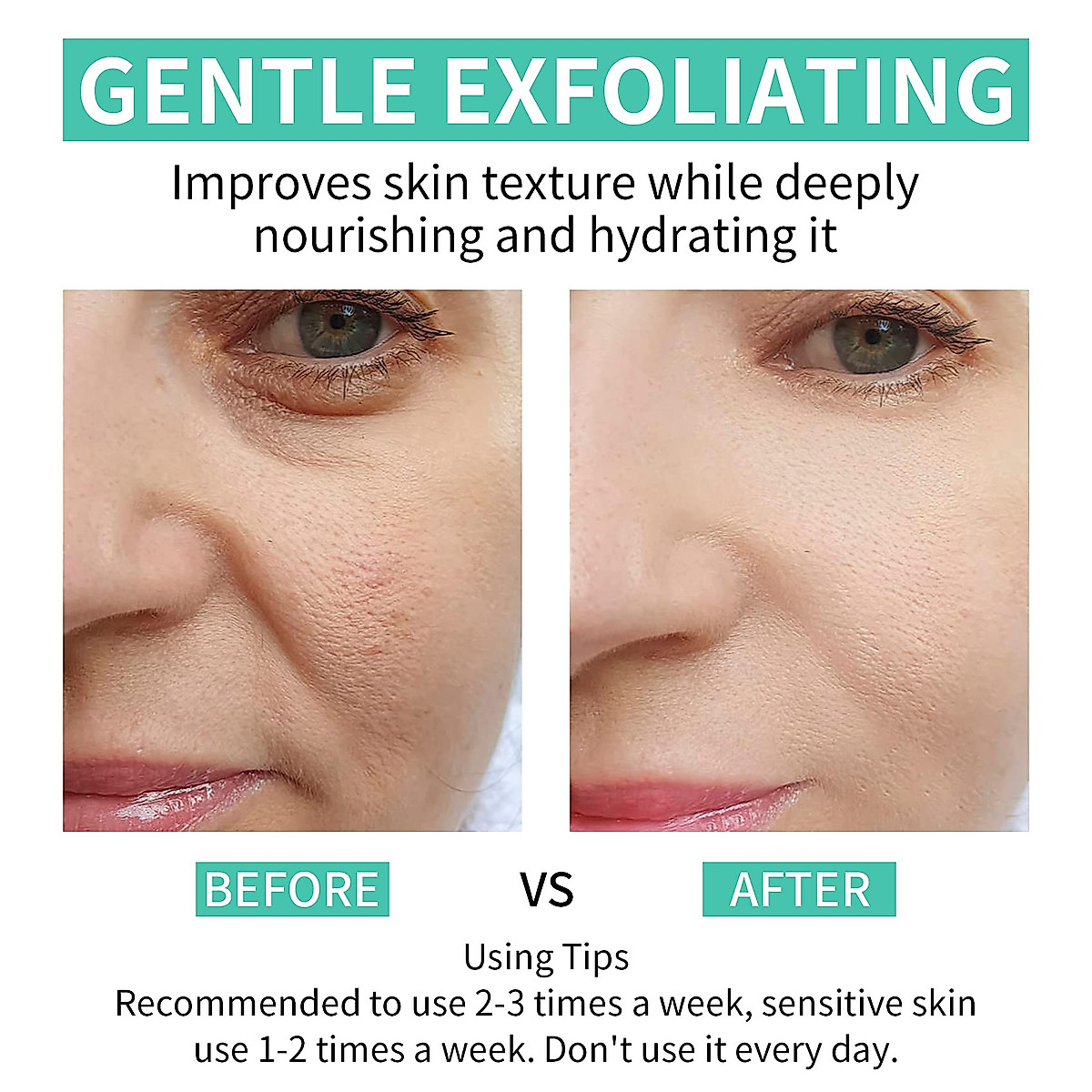 35% Glycolic Acid Pads for Face & Body, Exfoliating Facial Peel, AHA Resurfacing Pads with Vitamins B5, C & E, Green Tea, Glycolic Acid Peel Pads for Dark Spots Acne Fine Lines & Wrinkles 50 Pads