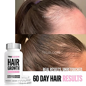 St. Tropica Tru Bloom Hair Growth Vitamins - 2 Month Supply. Clinically Proven for Fuller, Thicker Hair. Natural & Drug-Free. Ultimate Hair Vitamins for Proven Results