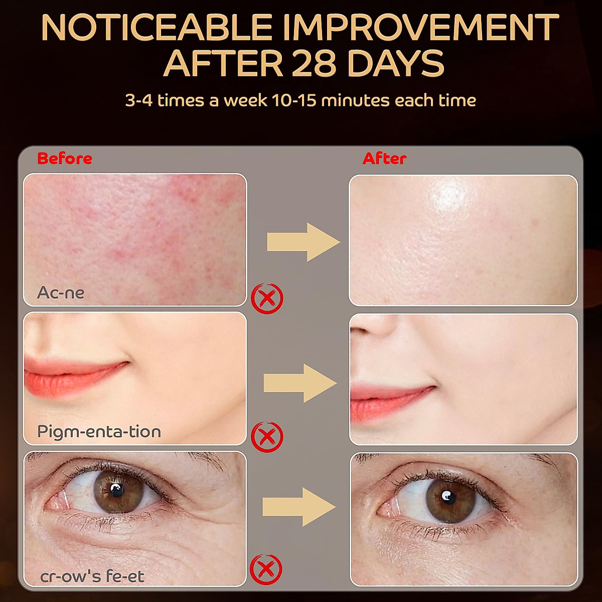 Hottoerak Red Light Therapy for Face, LED Red Light Therapy Mask 660nm & 850nm Wavelength for Home Use