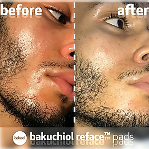 Indeed Labs Bakuchiol Reface Pads - Plant-based retinol alternative, no irritation, 5x more antioxidant. Good for acne-prone skin, sun damage, fine lines And wrinkles. 30 Pads