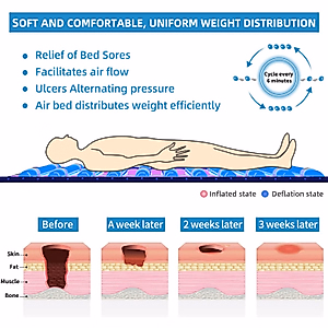 FITCONN Alternating Air Pressure Mattress, 33.5 Inch, Washable, Quiet Pump, Ideal for Bed Sores