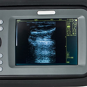 Colilove Veterinary Ultrasound Scanner Handheld Digital Ultrasound Scanner Veterinary Handscan V8 with 4.0MHz Rectal Probe for Pregnancy Check On Farm Animals Cattle/Horse/Camel/Equine/Goat/Cow/Sheep