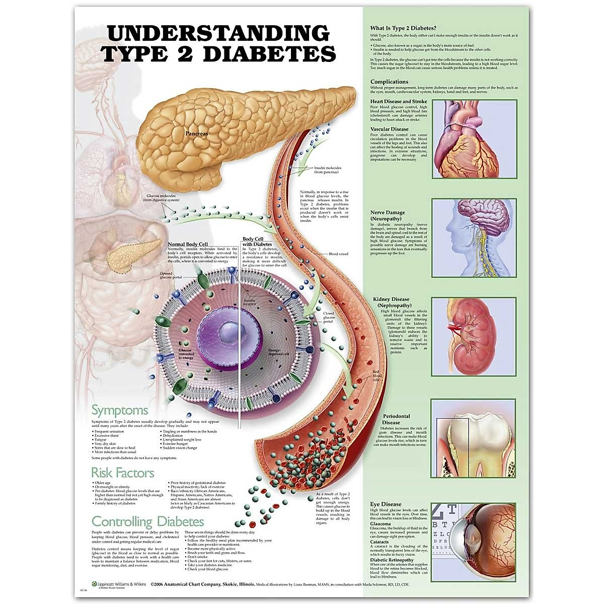 Understanding Type 2 Diabetes Anatomical Chart