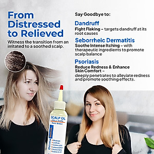 Dermasolve Psoriasis & Dandruff Oil, Dermatologist Approved for Flaky Scalp Relief