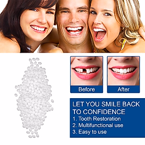 Tooth Repair Kit - Teeth Replacement Kit for Temporary Restoration of Missing & Broken Teeth Replacement Dentures, DIY Heat Fit Beads