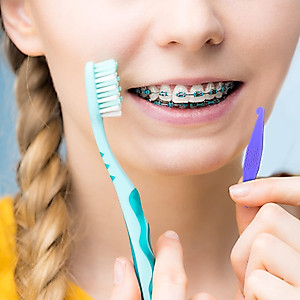 Nuanchu 50 Pcs Braces Rubber Band Tool Dental Elastic Rubber Bands Placers Disposable Orthodontic Elastic Placer Multicolor