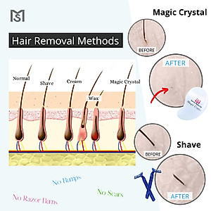 Magic Crystal Painless Hair Remover for Men and Women (New Technology) Fast & Easy - Soft Smooth Silky Skin, Clear Glitter