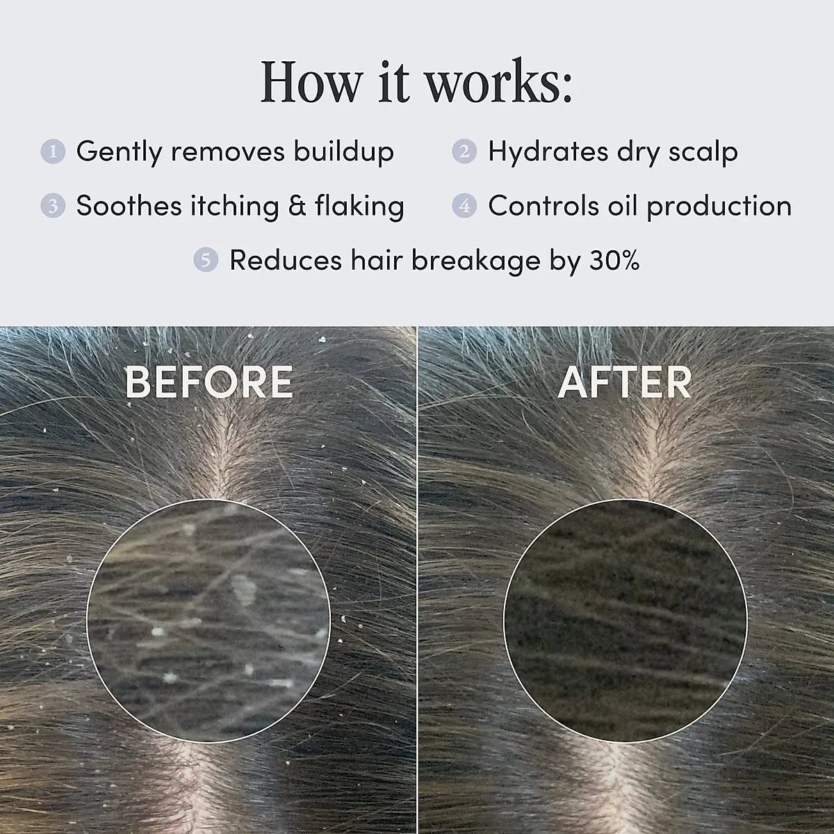 Jupiter Dandruff Shampoo with Serum Duo, Relieves Itchy, Dry, Flaky Scalp, Color-Safe, & Sulfate-Free, Vegan, Both with Zinc, Vitamin B5, Green Tea, Spot Treatment with Niacinamide & Aloe Vera