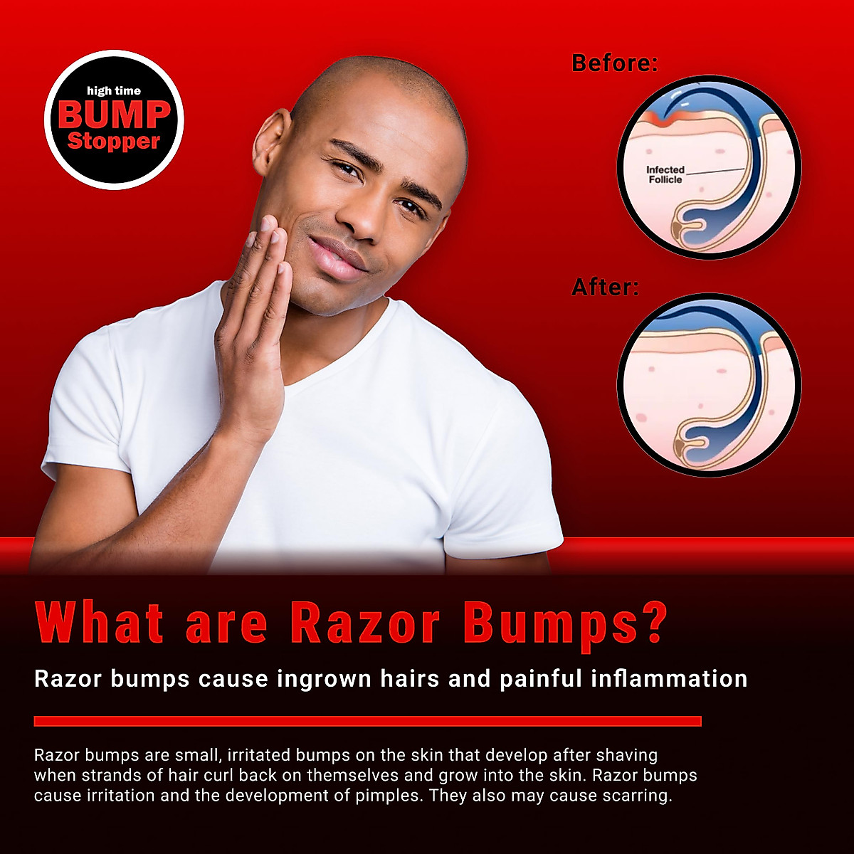 Bump Stopper 2 Double Strength Razor Bump Treatment | Formulated to Relieve Razor Burn | Eliminates Ingrown Hairs | Aftershave For Men - 0.5 OZ