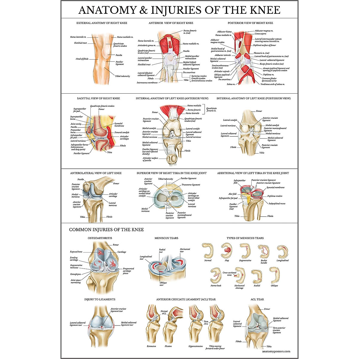 Palace Learning 2 Pack - Anatomy and Injuries of The Knee & Hip Poster Set - Anatomical Chart Set - Laminated 18" x 24"