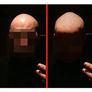 DermiMatch LLC Zero Shine 2.0 - Small - for scalp aftercare moisturizing mattifying effect for bald scalps or SMP Scalp Micropigmentation. Matte Scalp