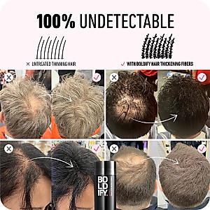 Hair Fiber (Dark Brown) + Hairline Powder (Dark Brown): Boldify Build & Conceal Bundle - Undetectable Hair Thickener for Fine Hair, Instant Stain-Proof Root Touchup Powder, For Men & Women