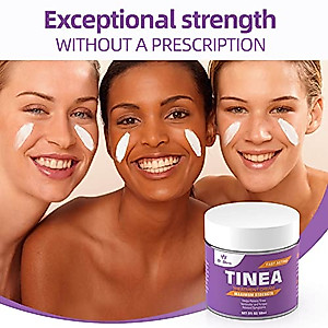 DR. DERM Tinea Versicolor Treatment, Antifungal Cream for Tinea Versicolor & Pedis, All-Natural Athletes Foot Treatment Ringworm Treatment for Humans, Fast Healing Anti Fungal Skin Cream