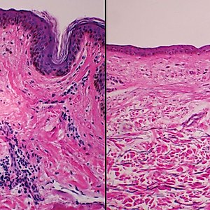 Human Pigmented And Non-Pigmented Skin Composite Sec. 7 M H&E Stain Microscope Slide