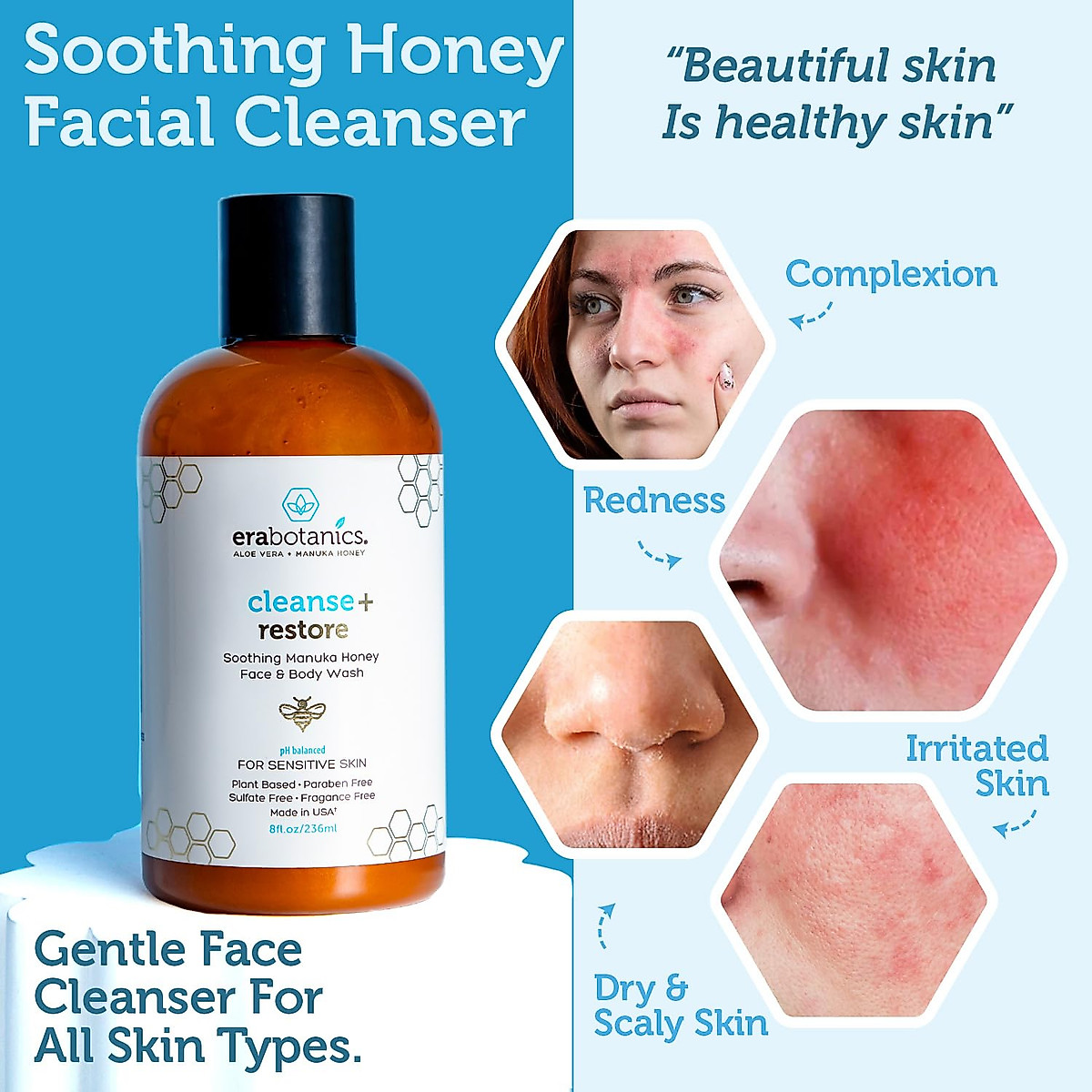 Manuka Honey Face Wash for Women and Men - Sulfate Free Moisturizing Cleanser with Organic Aloe Vera - Soothing Plus Gentle on Dry Skin Facial Cleanser Made in USA - 8oz