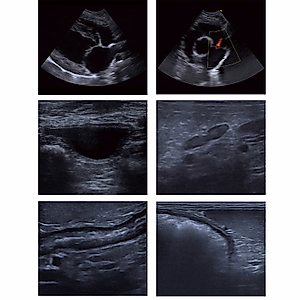 CONTEC Veterinary Ultrasound Scanner Color Doppler for Pregnancy in Animals Dogs Goats mare Horses Cattles with Tow probes convex and rectal linear probe