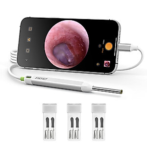 Anykit 3.9 mm Visual Digital Otoscope with 6 LED Lights and Earwax Removal Tool for Adults & Children, Compatible with iPhone & Android