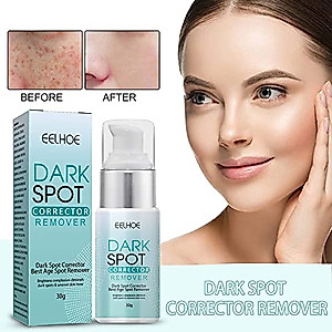 3Pack Musely Dark Spot Cream,Dark Spot remover for Face,The Spot Cream for Face,Dark Spot Correct Cream, Freckle Remover and Discoloration Correcting Serum