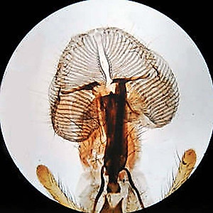 AmScope PS50A Prepared Microscope Slide Set for Basic Biological Science Education, 50 Biology and Pathology Slides, Includes Fitted Wooden Case