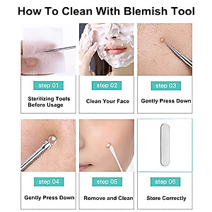 Pinkiou Blackhead Removers Comedone Pimple Popper Tool Acne Extractors Blemish Remover Ingrown Hair Tweezers Removal Kit Whitehead Remover Zit Treatment Skincare Tools for Face Nose, 8-in-1