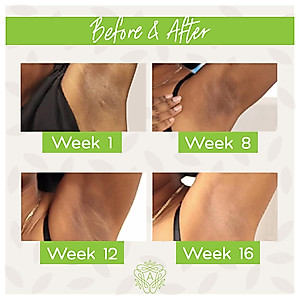 Amaira Skincare Intimate Natural Brightening Serum - Kojic Acid Dark Spot Corrector - Formulated for Sensitive Skin and Private Areas - Natural Plant-Based Formula (1.7 fl oz)