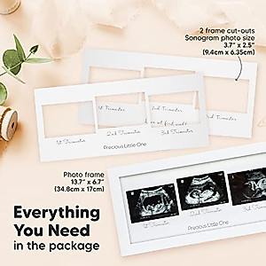 Sonogram Picture Frame - Trio Ultrasound Picture Frames For Mom To Be Gift - Baby Ultrasound frame - Pregnancy Announcements Sonogram frame - Baby Nursery Decor, Pregnant Mom Gifts (Alpine White)