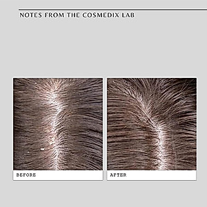 COSMEDIX Fortify Cooling Enzyme Scalp Treatment, 1 ct.