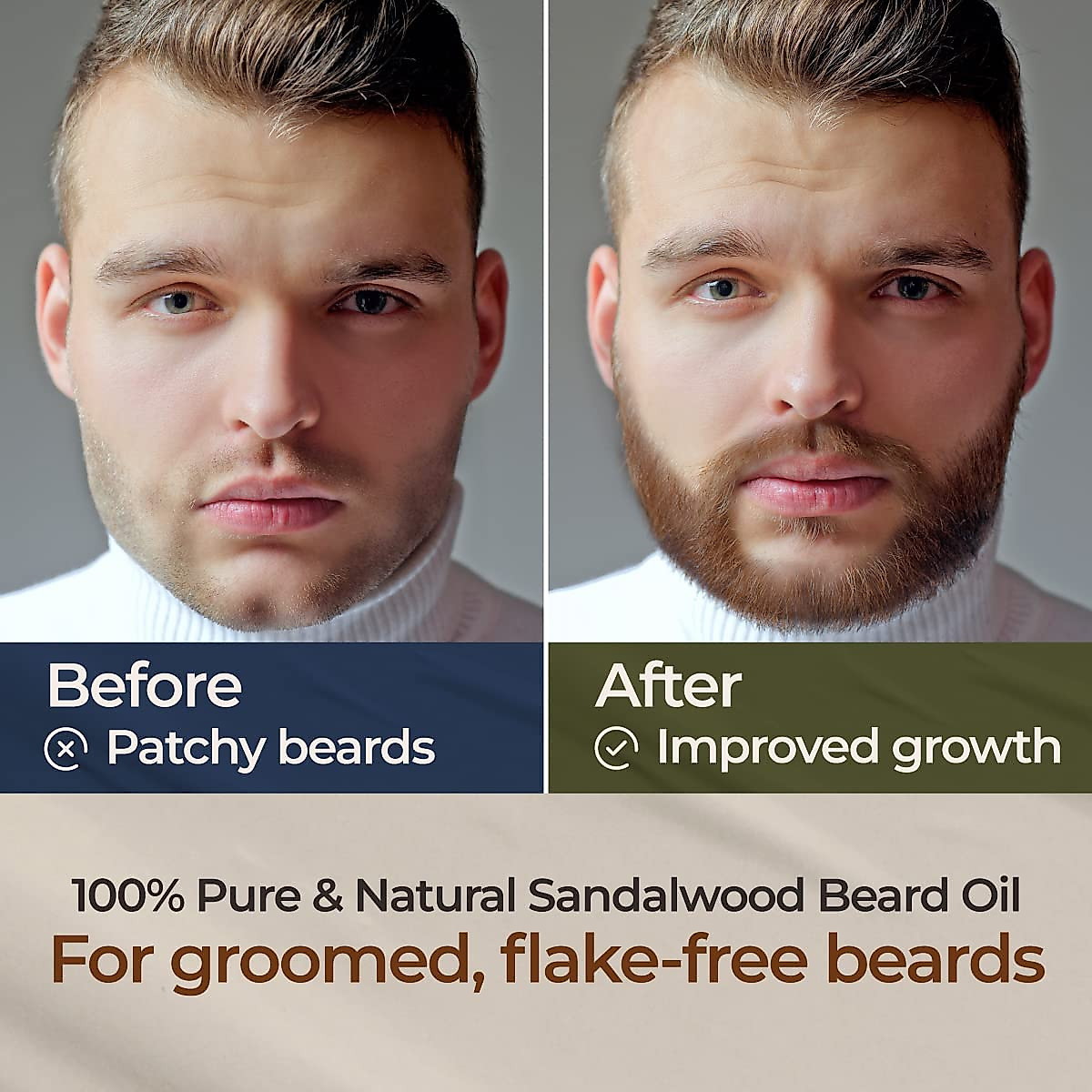 Gya Labs Sandalwood Beard Oil - 100% Pure & Natural Beard Growth Oil for Men with Organic Argan & Jojoba Oil - Beard Oil that Moisturizes, Softens & Strengthens (1 Fl Oz)