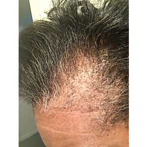 Kreyol Essence - Haitian Black Castor Oil for Skin and Hair, Glass Bottle - Fuller-Looking Hair, Hexane Free, Natural Humectant