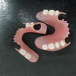 "Nesbit bridge" , Flipper Uppler and Lower Set of Affordability Flexible Valplast Customized Partial Denture (Pink, Valplast)