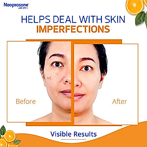 Neoprosone 20% Vitamin C Dark Spot Corrector Cream - 1 Fl oz / 30ml - Skin Brightening Gel Cream - with Hyaluronic Acid, Vitamin E