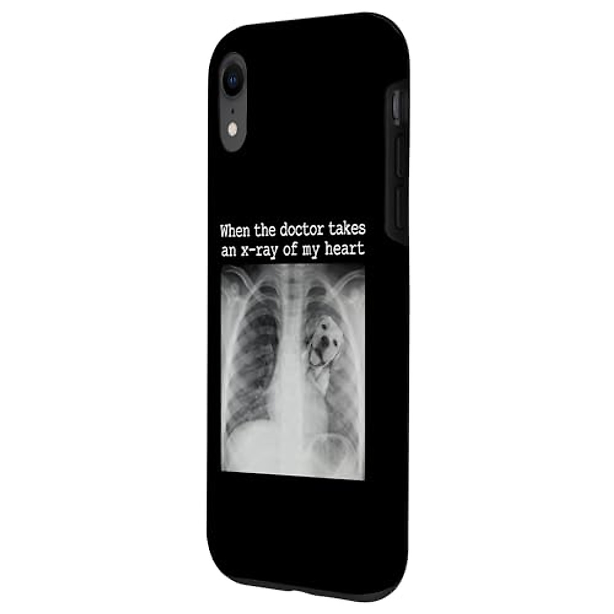 iPhone XR When The Doctor Takes an X-ray of My Heart Yellow Labrador Case