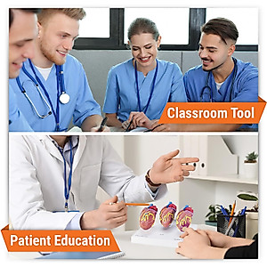 Heart Model Set | Human Body Anatomy Replica Heart Disease Set for Doctors Office Educational Tool | GPI Anatomicals