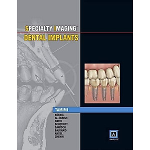 Specialty Imaging: Dental Implants