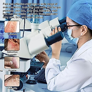 Eczema Psoriasis Manuka Relief Honey Cream, Hand Foot, Tinea Versicolor, Itchy Feet, Butt, Anal Itch, Scalp Dandruff, Bee Sting, Bites, Boil Cyst, Armpit, Adults Kids, Natural Organic Soothing