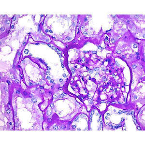 Schiff's Solution, 500ml