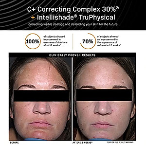 Revision Skincare C+ Correcting Complex 30%