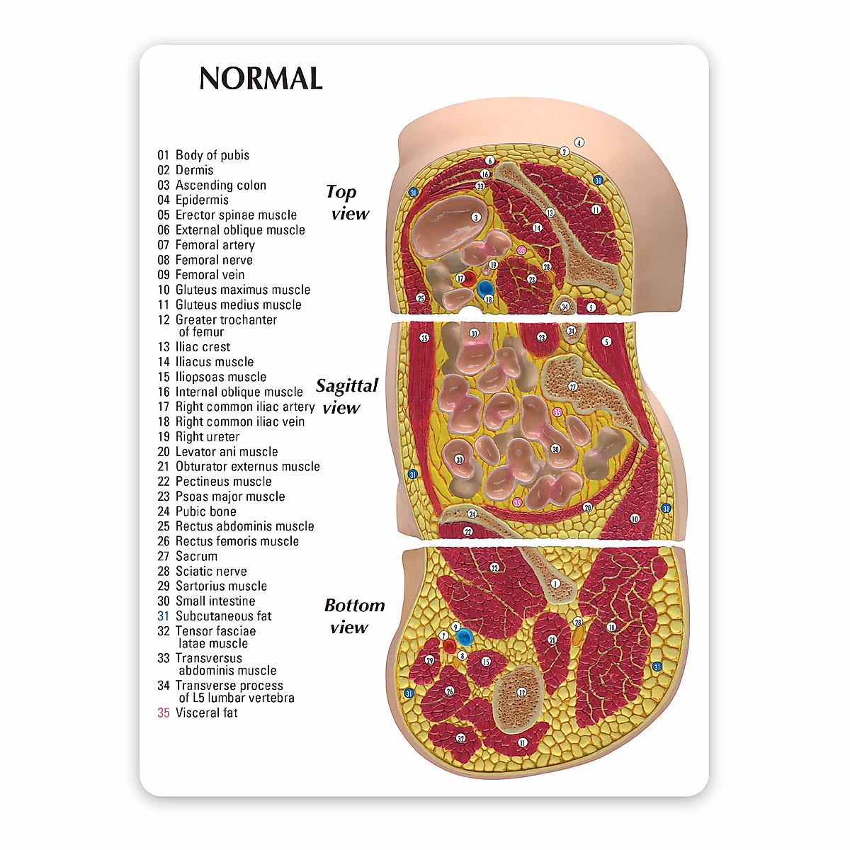 Obesity Model | Human Body Anatomy Replica of Overweight Body Types for Doctors Office Educational Tool | GPI Anatomicals