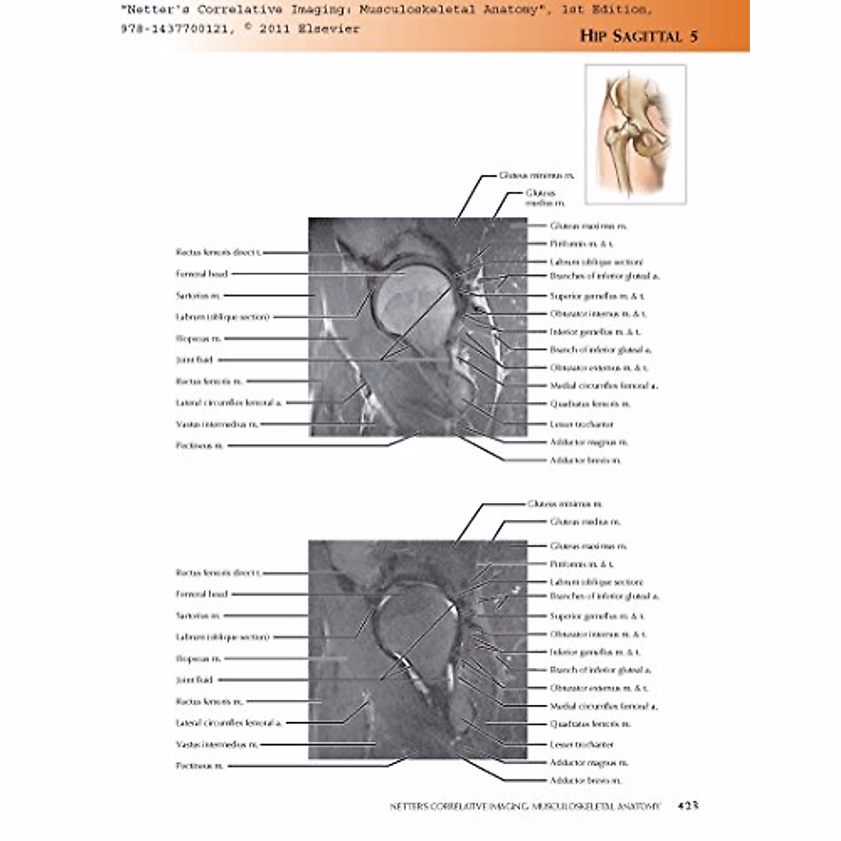 Netter's Correlative Imaging: Musculoskeletal Anatomy: with Online Access at www.NetterReference.com (Netter Clinical Science)