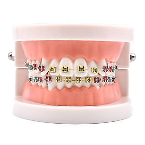 Angzhili 1 Piece Dental Demonstration Orthodontic Model with Metal Wires and Bracket (Metal bracket)