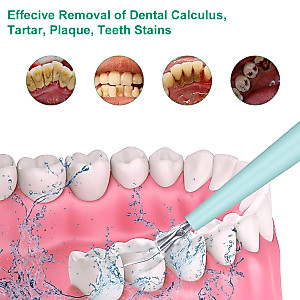 Electric Dental Calculus Remover, Sonic Tooth Scraper Plaque Tartar Stain Remover for Teeth High Frequency Vibration Teeth Cleaning Tools Kit with LED USB Rechargeable 3 Modes 2 Cleaning Heads (Blue)