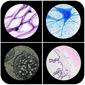 Plastic Prepared Microscope Slides for Kids, Cainda 60pcs Animals Insects Plants Flowers Biological Sample, Stereo Microscope Slide for Students Adult Biology Science Programs