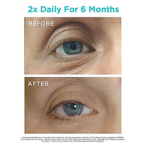 NEOCUTIS Lumière Illuminating Eye Cream | 5 Month Supply | Under Eye cream for anti-aging | Minimizes under eye darkness & reduces puffiness | Boosts Collagen for brighter, younger-looking eyes,1 Count (Pack of 1)