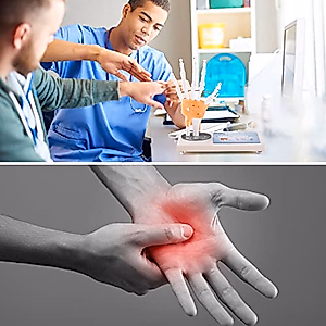 Ultrassist Human Hand Joint Model with Ligaments, Flexible 1:1 Scientific Life Size with 360° Rotatable Wooden Display Base, Includes Anatomy Diagram Best for Patient Education & Medical Training