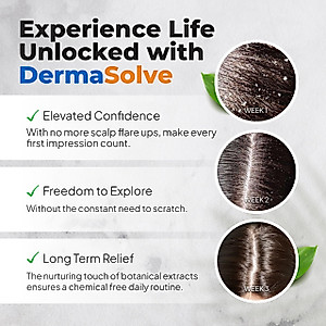 DermaSolve Scalp Psoriasis & Dandruff free Medicated Shampoo with Conditioner, Ultimate Seborrheic Dermatitis Treatment for Itchy, Flakey Scalp, Soothing & Moisturizing Relief