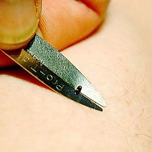 ProTick Remedy 5-Piece Kit (2 Pack) – Precision Steel Tick Remover, 5X Magnifier, Chain, Tick ID Card, Tick ID Information and Protection. Removes All Tick Species and Sizes from Humans and Animals